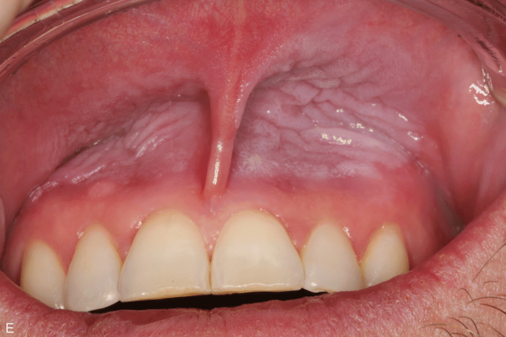 Can dentists tell if you sniff? Facts & tips | Stingfree